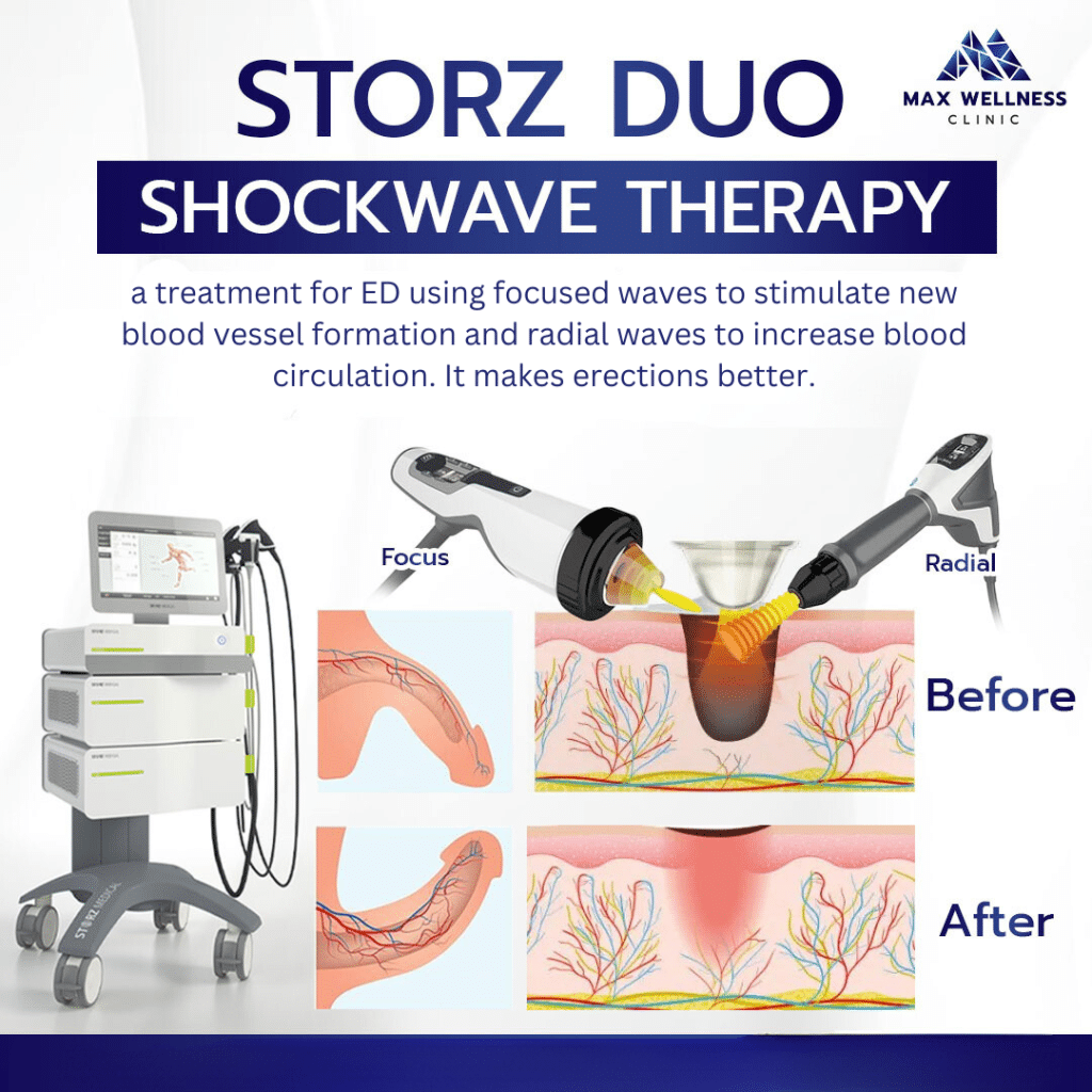 Storz Duo Shockwave Eng - Max Wellness Clinic